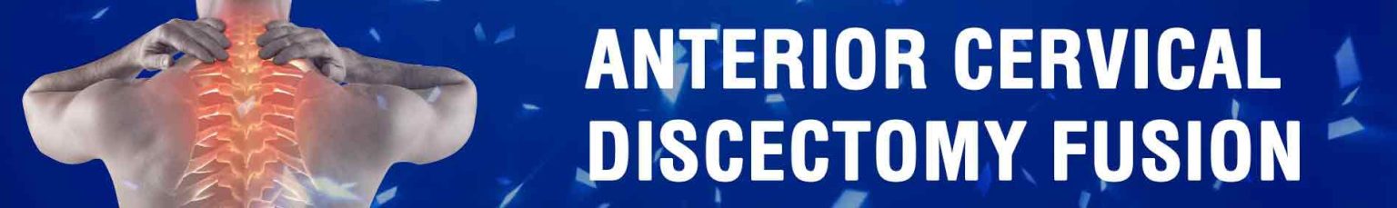 ANTERIOR CERVICAL DISCECTOMY FUSION – Delhi Ortho Spine